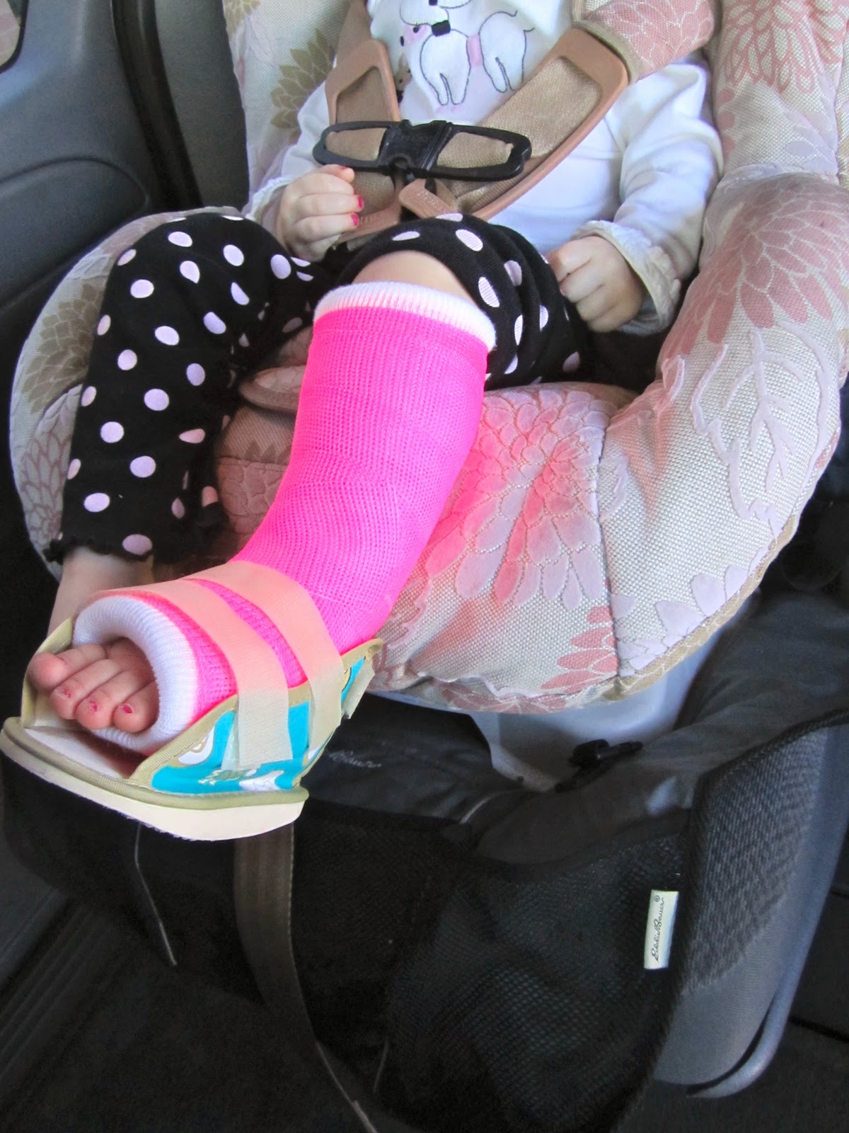 The Thomas Family: Poor little broken foot!