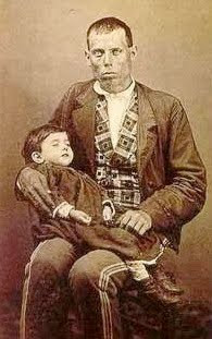 Early Post Mortem Photography: Dead Baby with Father