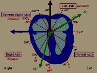 KURSUS EKG Bagian II: II.4. Aksis Jantung