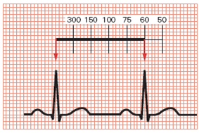 KURSUS EKG Bagian III: III.1. Cara Menghitung Frekuensi Denyut Jantung