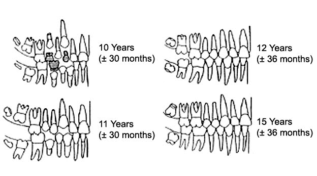 Flesh and Bones: VISUAL AID: AGE ESTIMATION FROM TEETH
