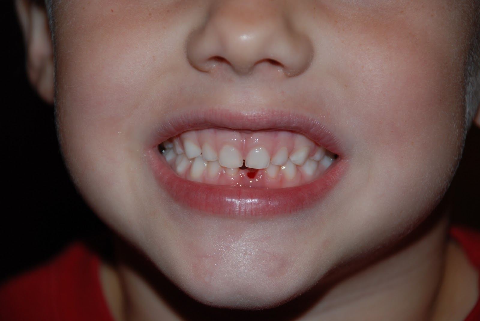 The Cole's: Little Snaggle Tooth