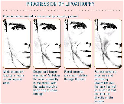 Plastic Surgery for Men: Plastic Surgery for Men QT: What causes facial ...