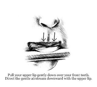 Jennifer Cluff: Top Teeth where Upper Lip should be