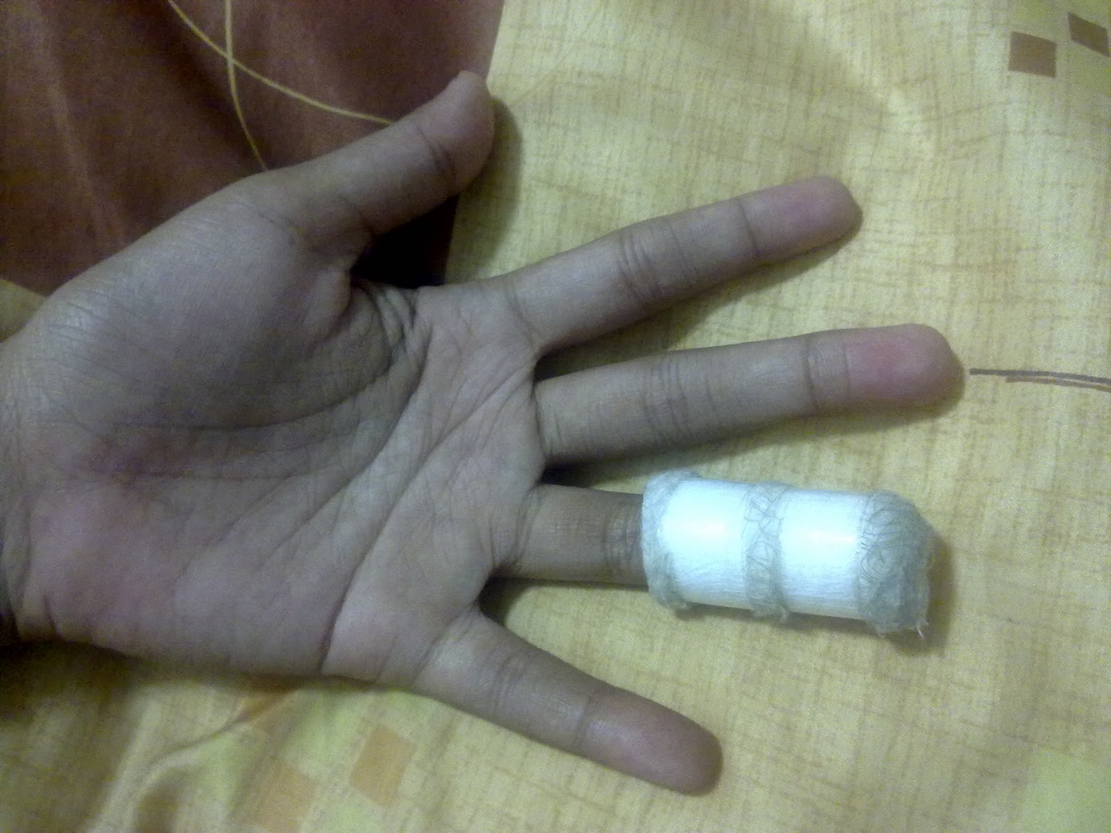 aku TeTap aku : : .: Luka Berdarah