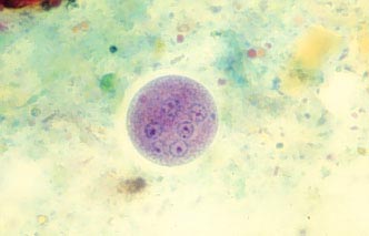 medicine: Entamoeba Coli