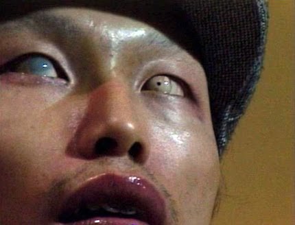 EDAOLALA: Mata Buta Sebelah Sebab Pakai Contact Lens