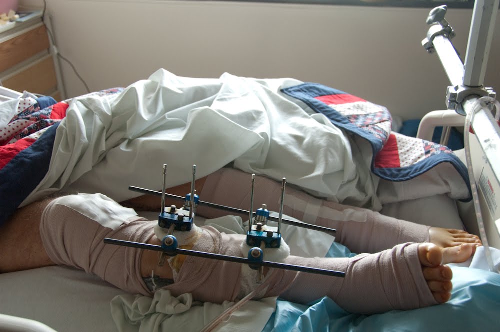 Recovery: Kyle's First Weekend in Bethesda - Photos Courtesy of Kat Deem