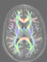 Brain Safari -- my job: Brain Atlas: Brodmann Areas for fMRI