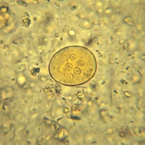 julian: Entamoeba coli.