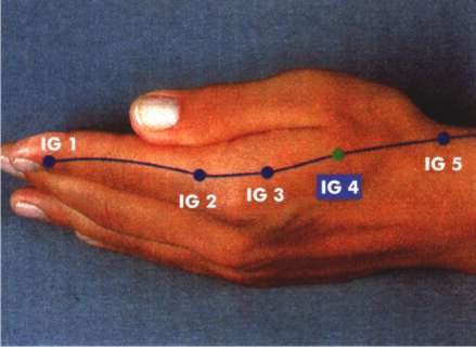 Moxabustão: Pontos e Indicações - IG4