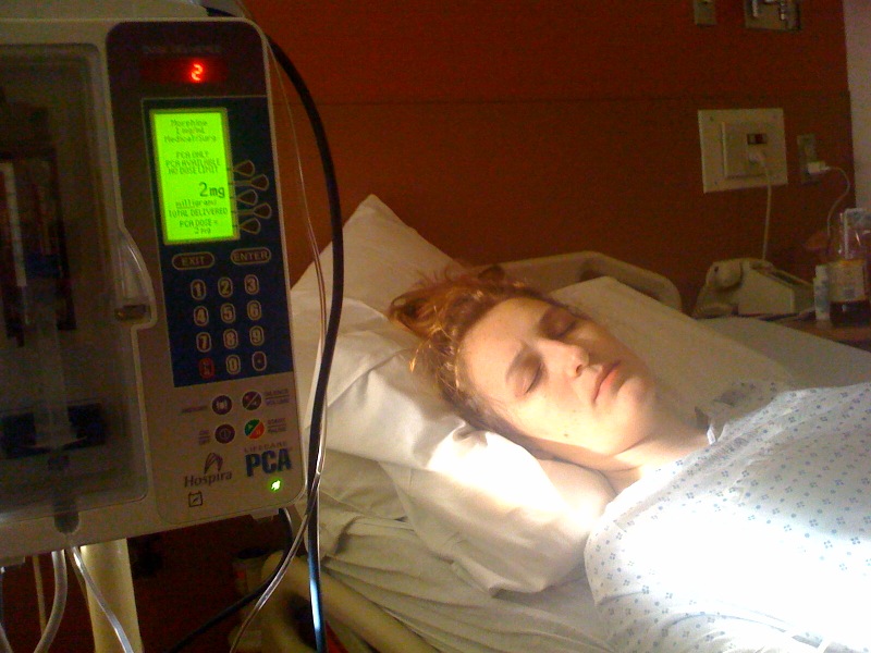 the swollen colon: Pictures