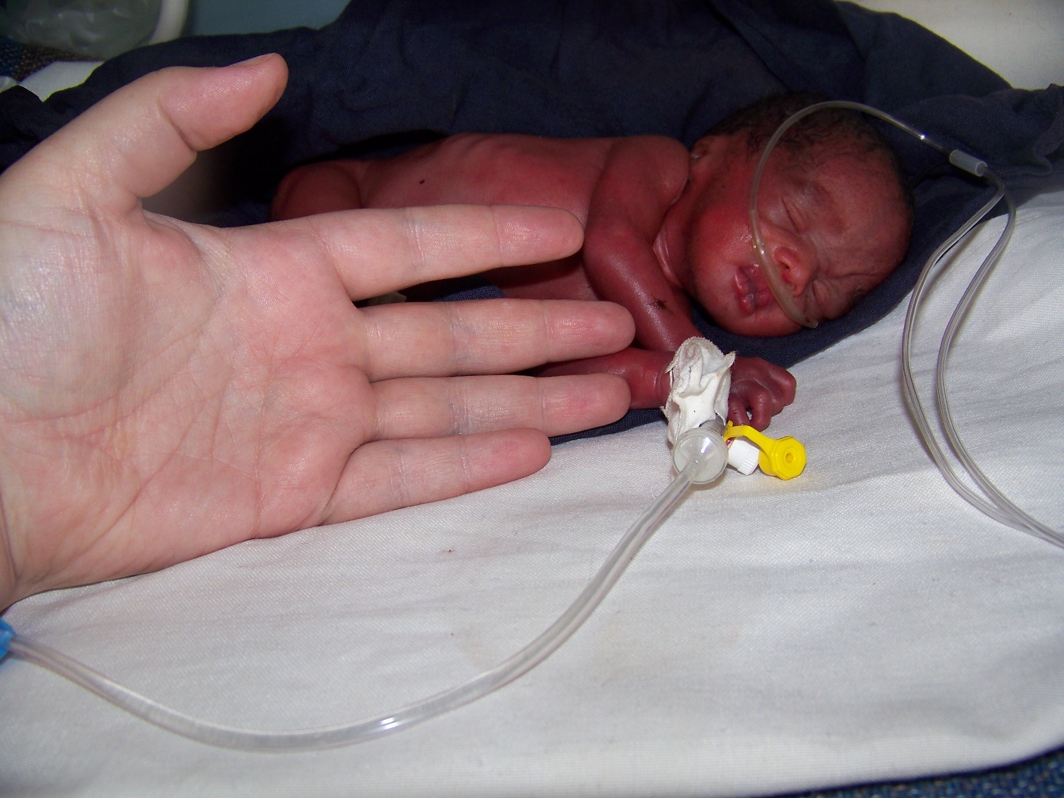 Christina's Blog: MIRACLE BABIES