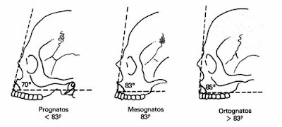 Turma 4.º Ano A -EB1 S. Victor - Braga: Ângulo facial