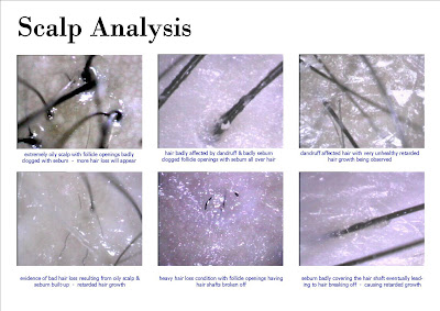 Hair And Scalp Wellness: Sample Scalp Analysis