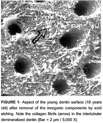 Public health: Teeth under a Microscope-Enamel