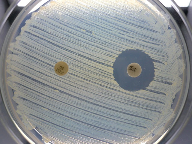Aa 上宇部こどもクリニック 抗生物質の薬剤感受性試験:ディスク法 Kirby Bauer Antibiotic Testing