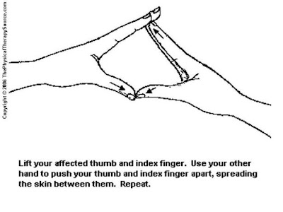 Hand Exercises from ThePhysicalTherapySource.com: Hand - Web Space Stretch