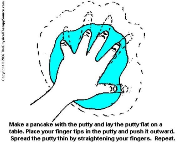 Hand Exercises from ThePhysicalTherapySource.com: Hand - Gross Finger ...