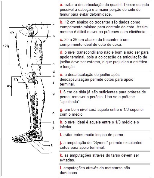 Ortopedia Técnica: AMPUTAÇÕES DO MEMBRO INFERIOR