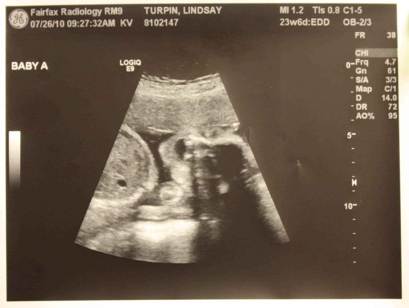 Adventures in Baby Making: Week 24 Ultrasound