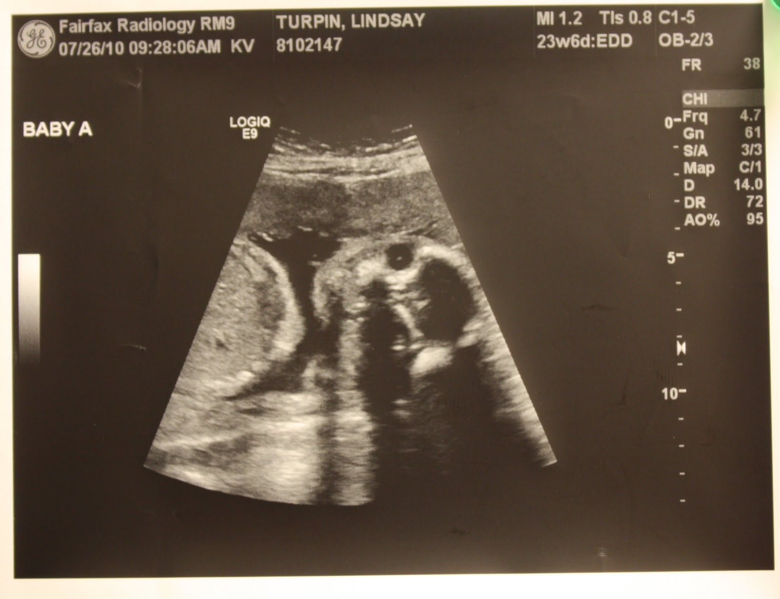 Adventures in Baby Making: Week 24 Ultrasound