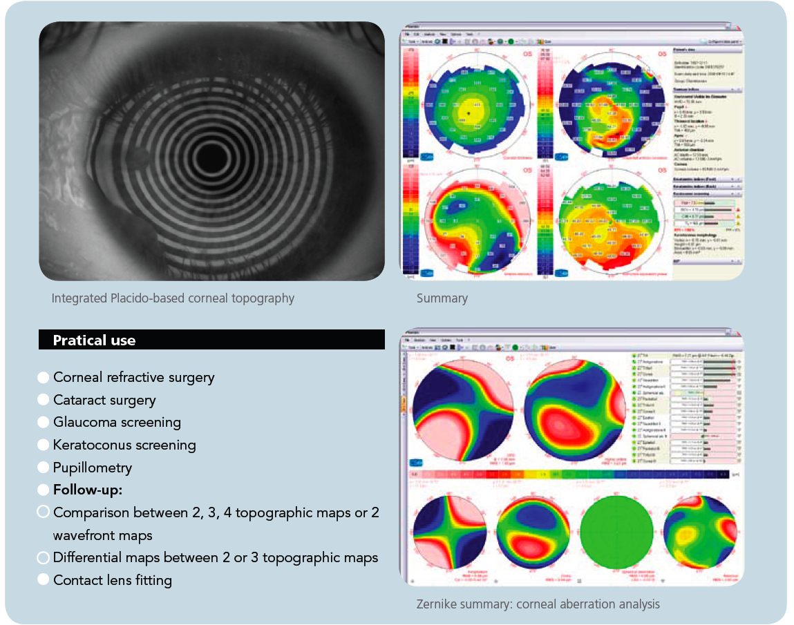 Retina Foundation's Eye Care Blog: Sirius- The Combined Placido and ...