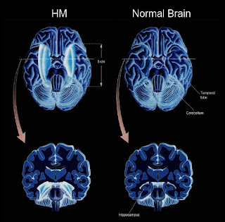 Philosophical Disquisitions: January 2010