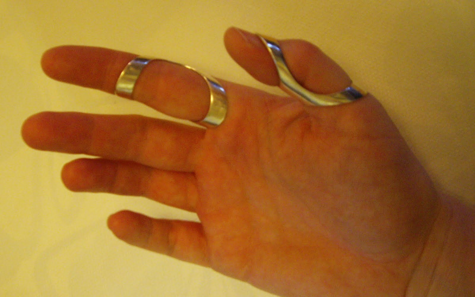 Au! 34+ Lister over Smerter I Tommel? Tommelsmerter kan være en ...