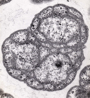 Tony's thoughts on the Natural World: 13b. Bacteria and other ...