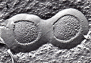 Tony's thoughts on the Natural World: 13b. Bacteria and other ...