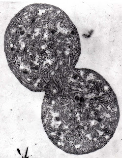 Tony's thoughts on the Natural World: 13b. Bacteria and other ...