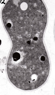 Tony's thoughts on the Natural World: 13c. Bacteria and other ...