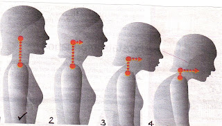 Good health and the odd sundry item.: Forward Head Posture Syndrome