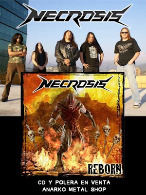 Anarko Metal Shop