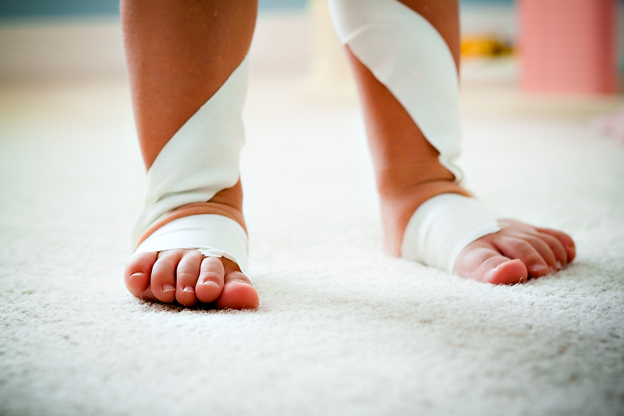 The Dagupion 'Ohana: Kinesio Taping