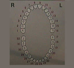 ORTODONCIA LINGUAL: Numeracion de tus dientes