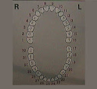 ORTODONCIA LINGUAL: Numeracion de tus dientes