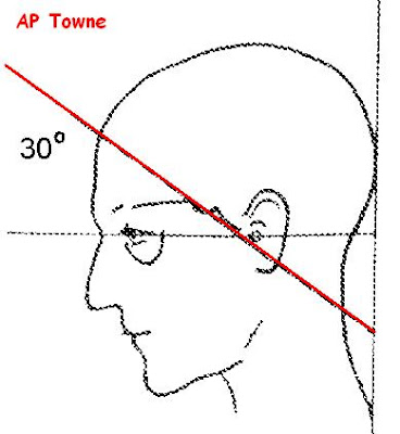 Mountain Imaging: Skull Positioning