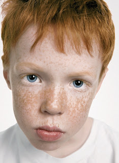 Os Ruivos: O BEBÊ RUIVO MAIS BONITO DO BRASIL