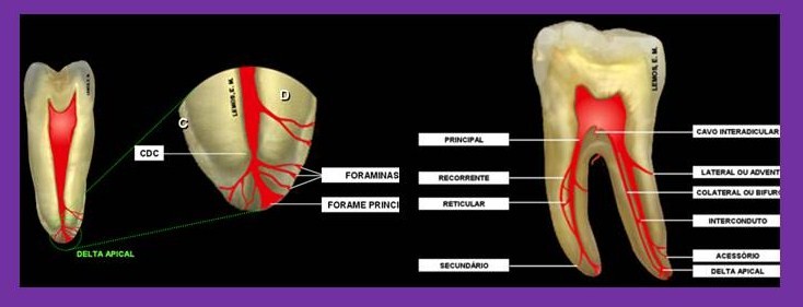 ENDODONCIA Casos Clínicos: CONDUCTOS LATERALES