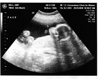 The Bell’s Chime of the Times: 20 week ultrasound