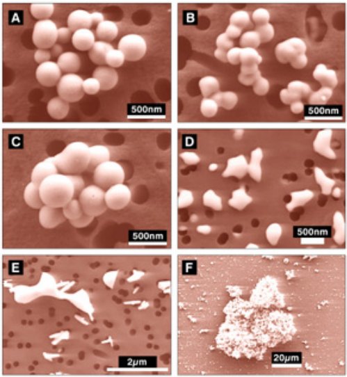 Digamos NO! al Nuevo Orden Mundial: MICRO-PARTÍCULAS en VACUNAS AH1N1 ...