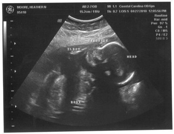 Anonymously Pregnant: Week 21 Movements and Gender