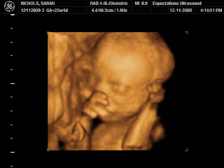 The Nichols Family: 3d/4d Ultrasound 22 Weeks!