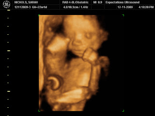 The Nichols Family: 3d/4d Ultrasound 22 Weeks!