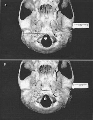Chimpanzee Information: Picture, Chimpanzee Skull