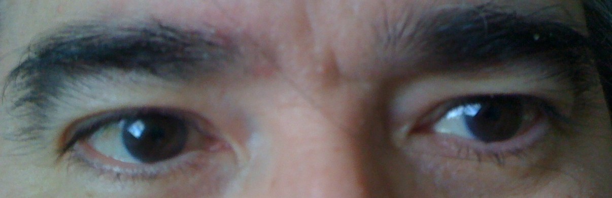 Not My Second Opinion: Double Vision