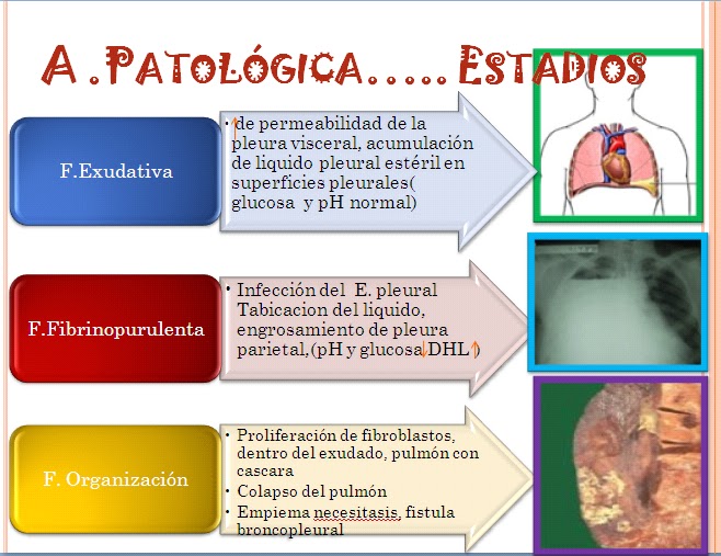 PRUEBAMODULO 2: DESARROLLO DEL TEMA (EMPIEMA)