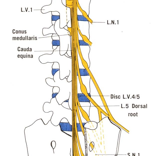 Dr.Sharath's Blog: Epiconus, Conus and Cauda Equina syndromes